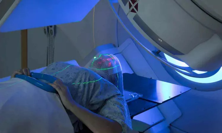 Proton Therapy Demonstrates Advantages in Phase III Head and Neck ...